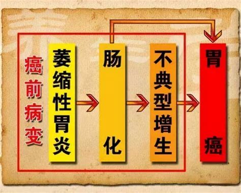 萎縮性胃炎真的「很嚇人」？看完這五個事實 每日頭條