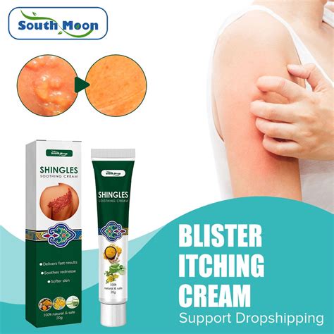 South Moon Shingles Soothing Cream Inhibit Skin Fungus Cream Dermatitis