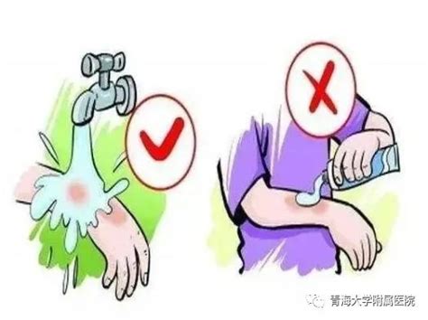 常见宠物抓咬伤怎么办？ 青海大学附属医院