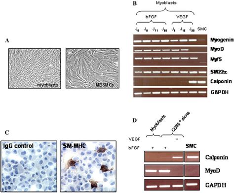 A Outgrowth Cell Morphology Of Myoblasts Or Mdsmcs Same