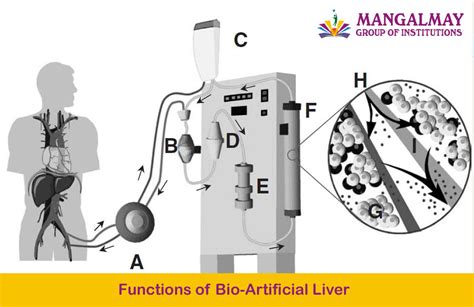 Artificial Liver