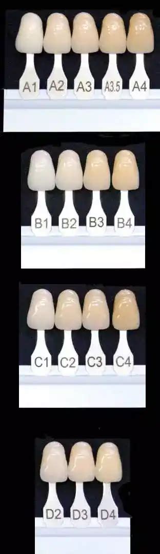 Teeth Color Chart And Natural Tooth Shade Oral Health