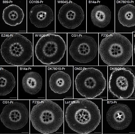 Natural Variation Of Maize Root Hydraulic Architecture Underlies Highly Diverse Water Uptake