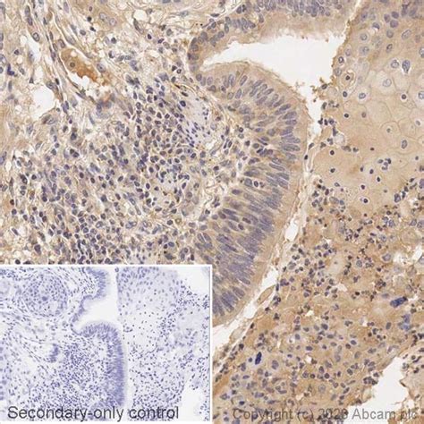 Recombinant Biotin Anti Tissue Plasminogen Activator Antibody Epr7232
