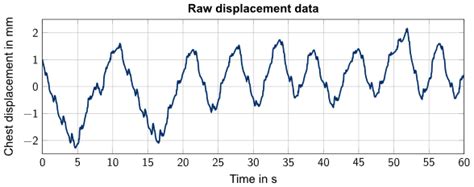 radar based vital sign detection