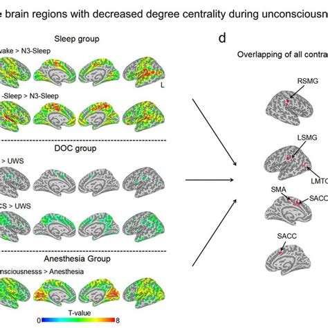 Pdf Higher Order Sensorimotor Circuit Of The Brains Global Network Supports Human Consciousness