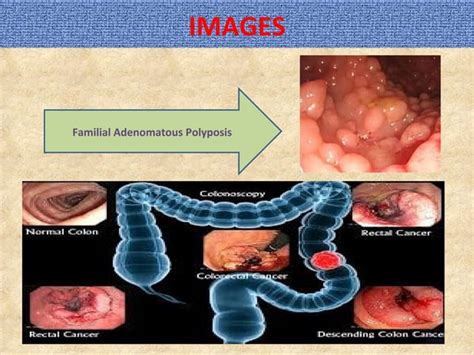Beta Catenin Final Ppt