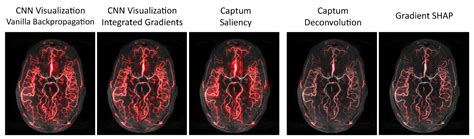 applied sciences free full text torchesegeta framework for interpretability and
