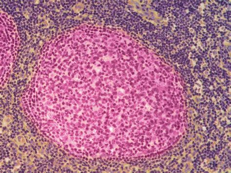 Lymph Node Light Micrograph Stock Image F0115469 Science Photo