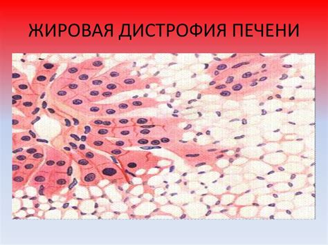 Дистрофии Паренхиматозные мезенхимальные смешанные презентация онлайн