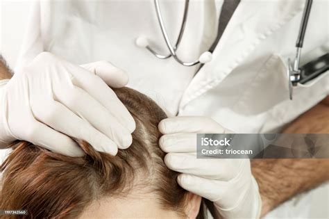 여성 모발 두피 두피 습진 피부염 건선 탈모 비듬 또는 건조한 두피 문제를 검사하는 의사 털에 대한 스톡 사진 및 기타 이미지