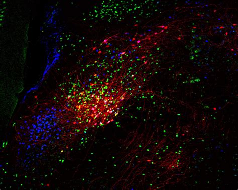 A Paradigm Shift In Neurobiology The Brains Anti Inflammatory