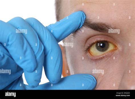 Man Checking His Health Condition On White Background Closeup Yellow