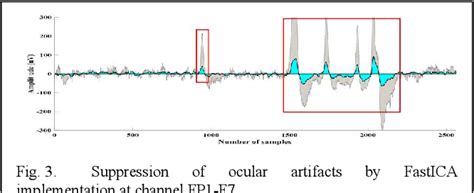Figure 3 From Automatic Removal Of Ocular And Cardiac Artifacts And