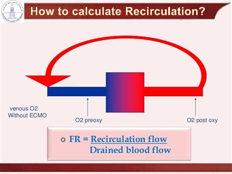 Cannulation And Recirculation In Vv Ecmo