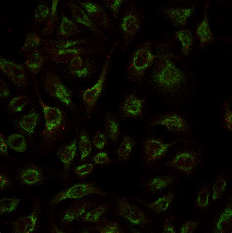 Colocalization Problem With Imagej Analysis Image Analysis Imagesc
