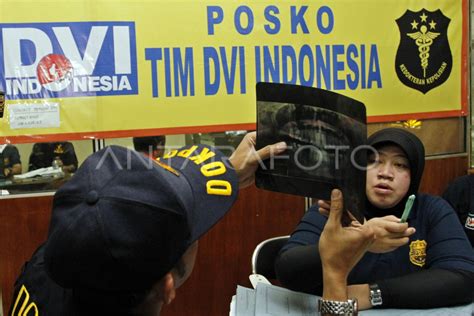 Sample Dna Antara Foto