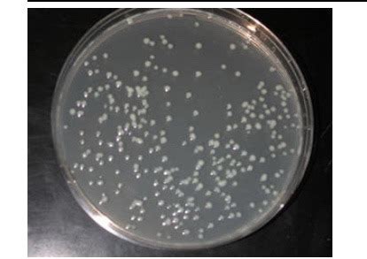 Lab Ubiquity Of Microbes Flashcards Quizlet