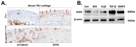 Sox9 Expression Was Significantly Decreased In Tmj Cartilage Of 3 Month