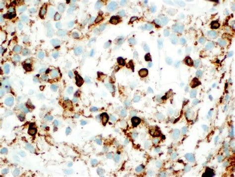 A Haematoxylin And Eosin Stained Tissue Section From The Chin Punch