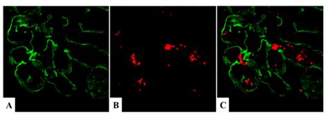 Naplr Localization Relative To The Glomerular Basement Membrane