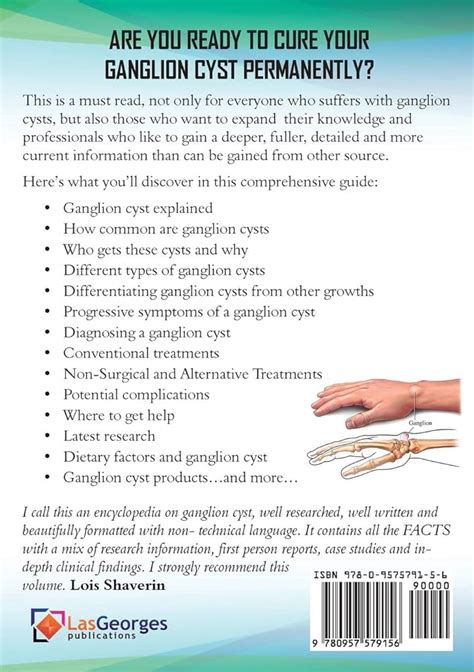 Ganglion Cyst Cure A Complete Treatment Guide To Ganglion 57 Off