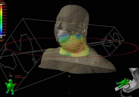 Promoting Management And Leadership Planning