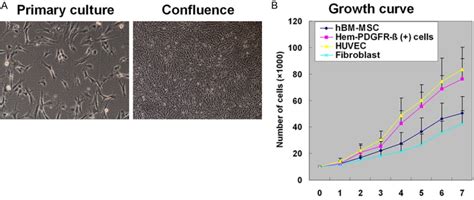 Pdgfr β Perivascular Cells From Infantile Hemangioma Display The