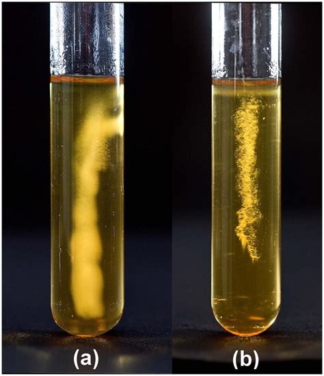 Motility Of C Difficile Strains In Bhis Agar 0175 Ac Difficile