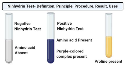 Ninhydrin Test Definition Principle Procedure Result Uses