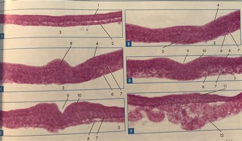 Transverse Sections Thru 18 Hour Embryo Diagram Quizlet