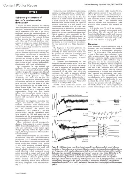 Isolated Hypesthesia In The Right V2 And V3 Journal Of Neurology Neurosurgery And Psychiatry