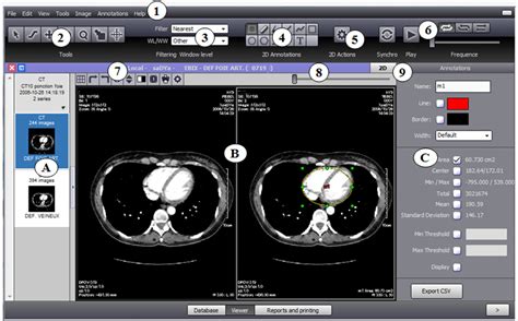 Onis Viewer Dicom Viewer And Pacs