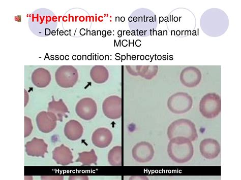 Ppt Red Blood Cells Powerpoint Presentation Free Download Id745427 Ppt Red Blood Cells Powerpoint Presentation Free Download Id745427