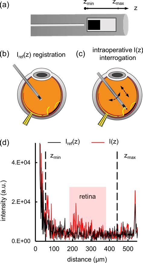 Overview Of The Intraoperative Retinal Detection A Schematic Drawing