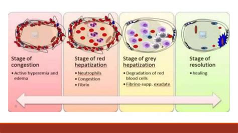 Pneumonia Pathophysiologypptx