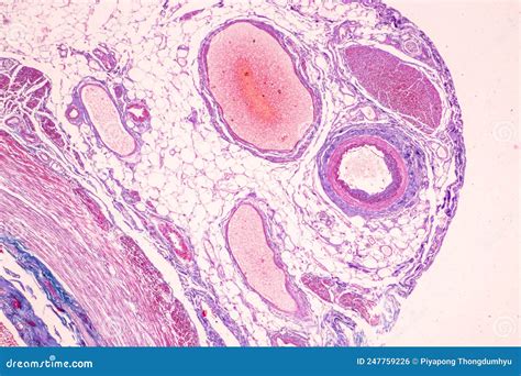 Small Intestine Duodenum And Vermiform Appendix Human Under The
