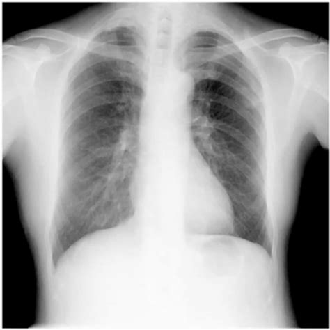 Dynamic Digital Radiography Konica Minolta