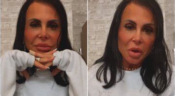 Cenapop Gretchen cancela cirurgia de doença que a fez parecer grávida Senti que não