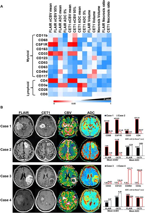 Illustration Of Correlation Between Mri Parameters And Immune Cell