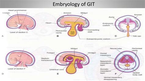 Omphalocele Vs Gastroschisis