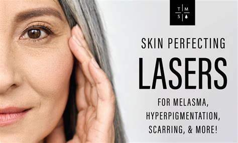 Lasers For Hyperpigmentation And Melasma — The Med Spa