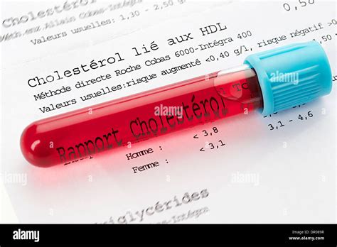 High Cholesterol Blood Test Hi Res Stock Photography And Images Alamy
