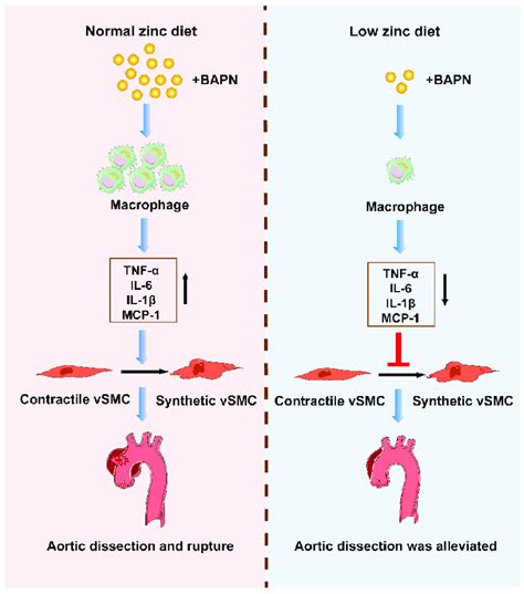 Schematic Illustration Of Low Zinc Alleviated The Progression Of TAD