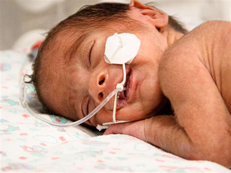 Uti Neonatal Maternidade Santa Marta