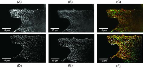 Wide Field Diffraction Limited Images Ac And Super Resolved Download Scientific Diagram