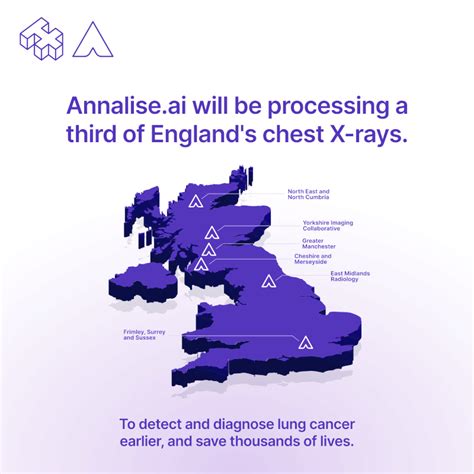 Aamir Bijapure On Linkedin Ai Medicalimaging Cxr