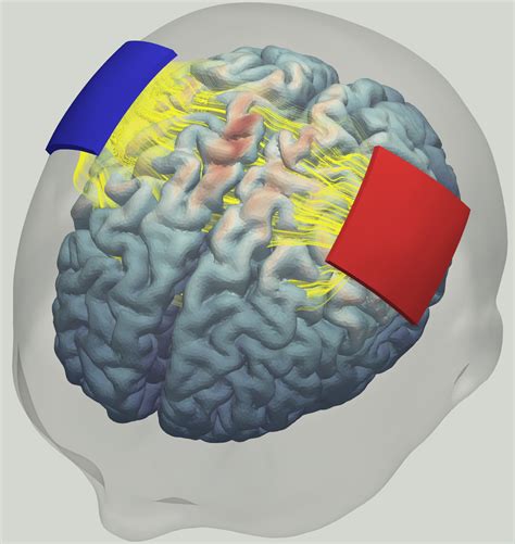 Simulation Of Tdcs Max Planck Institute For Human Cognitive And Brain