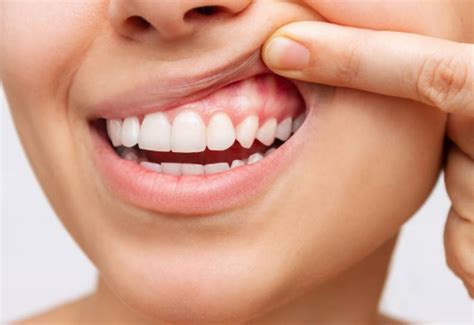 Common Dental Problems And How To Prevent Them Positive Healthcare