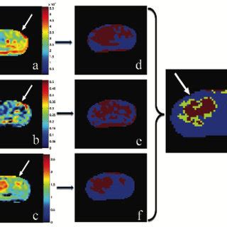 Estimated Characteristics Apparent Diffusion Coefficient D A Download Scientific Diagram